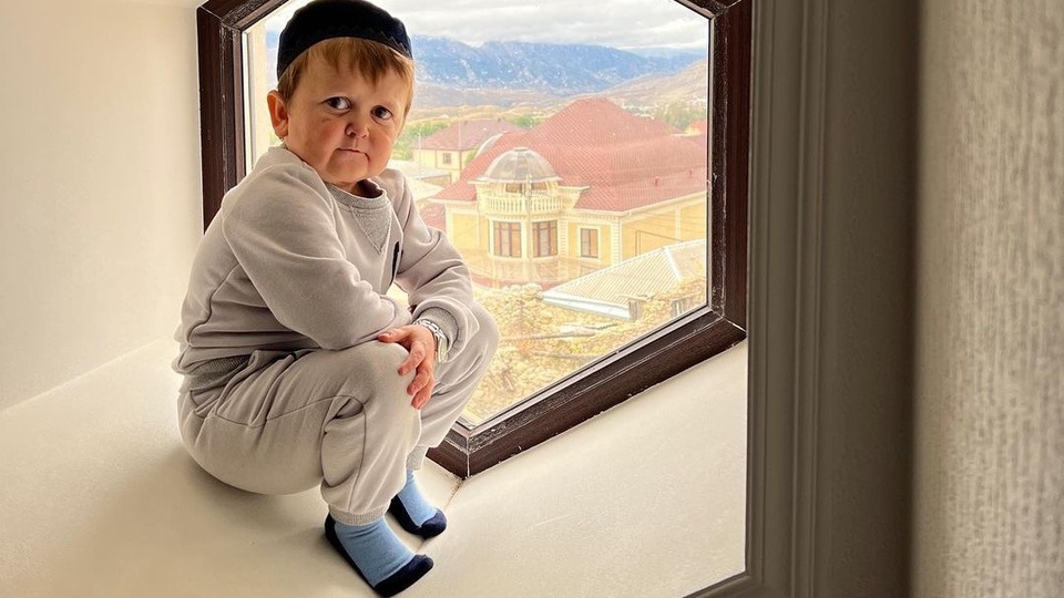 Qué es la acondroplasia, la enfermedad con la que vive Hasbulla ...