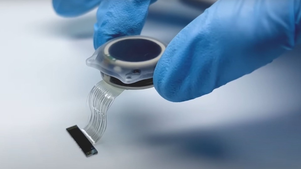 Cómo funciona Telepathy, el chip cerebral de Neuralink para controlar ... Cómo funciona Telepathy, el chip cerebral de Neuralink para controlar ...