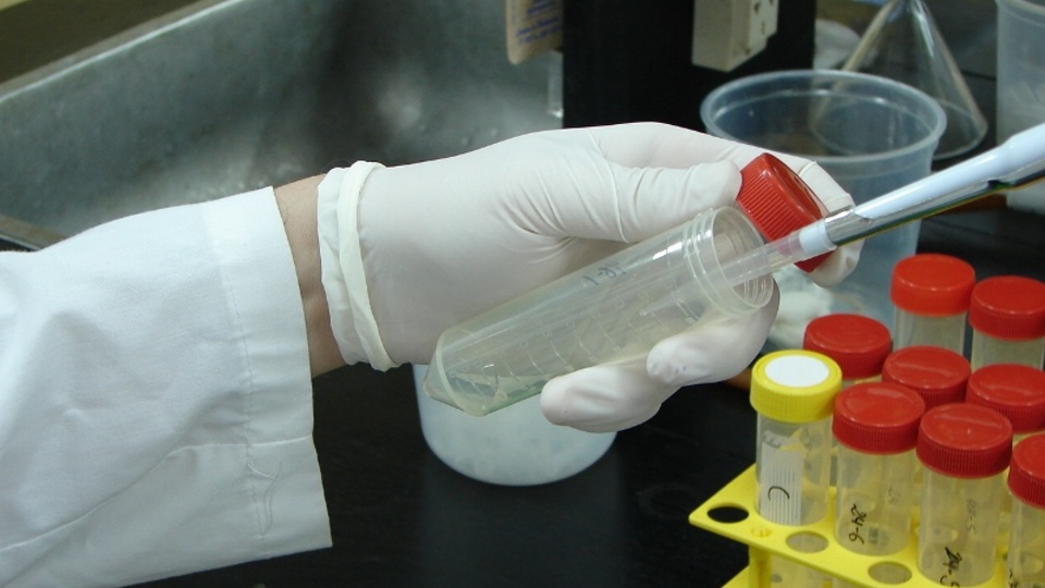 Dengue: El INTA creó un biolarvicida contra el mosquito que transmite ...